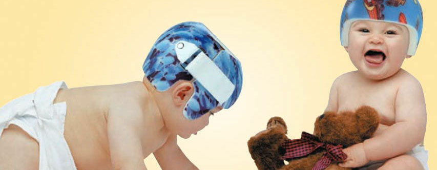 Cranial Remodeling rthosis - Cranial treatment in uae - Al Rehab